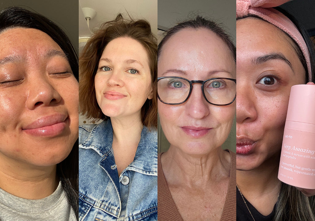 Very Amazing Reviews Of Very Amazing Retinal – Go-To Skincare