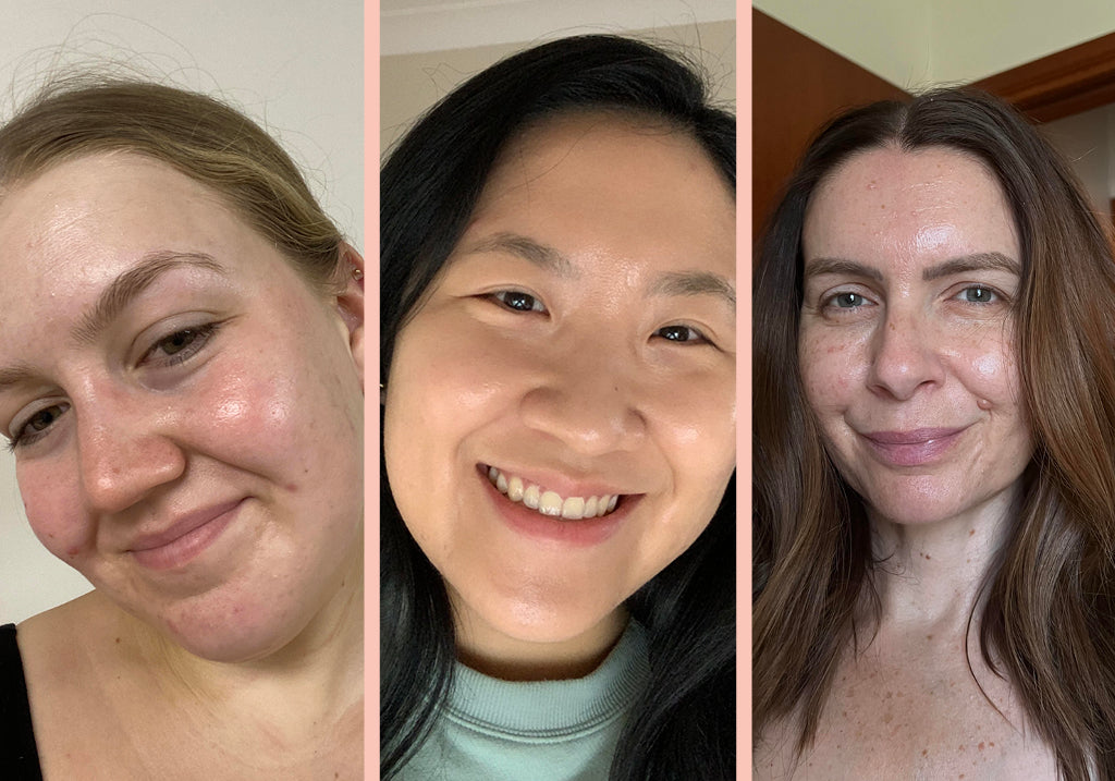 How Much Plumper Skin Works For Different Skin Types | Go-To Guide | Go ...